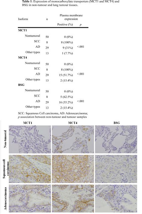 Immunohistochemical expression of the monocarboxylate transporters ...