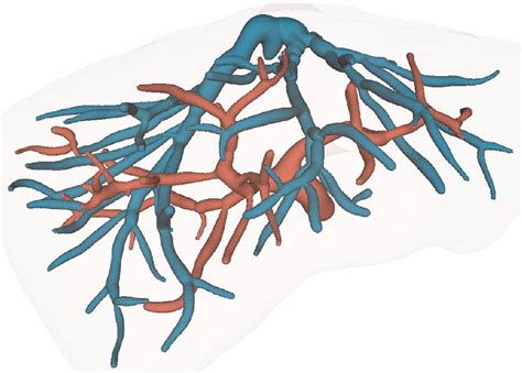 Minimally Invasive Segmental Hepatic Resection Clinical Tree