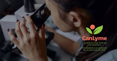 Lyme Neuroborreliosis A Case Report Canlyme Canadian Lyme Disease