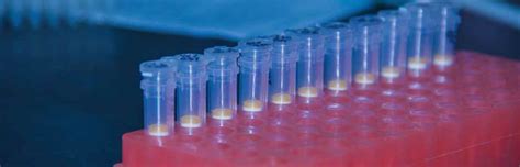 Nucleic Acid Quality No More Spin Columns Needed