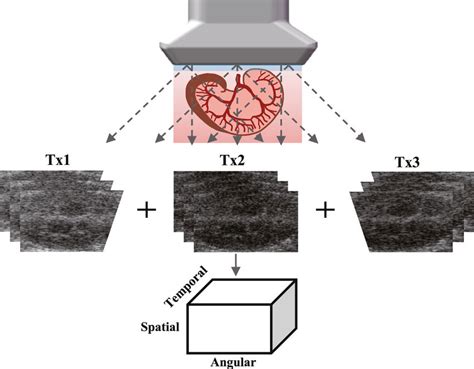 schematic of angular ultrasound doppler data acquisition and its 3d