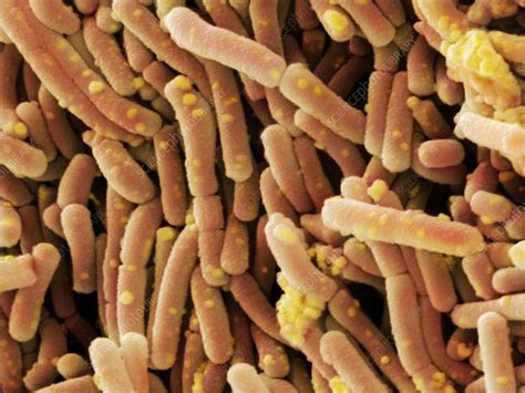 Lactobacillus Casei Bacteria Sem Stock Image C014 9331 Science