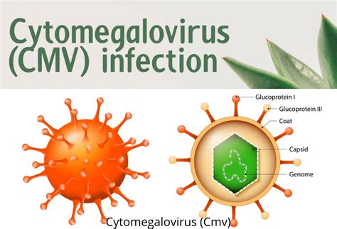 Congenital Cytomegalovirus Nord Video Anatomy Osmosis 42 Off