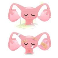 Page 3 Vaginal Discharge Vector Art Icons And Graphics For Free Download