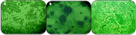 Pathogenesis Of Viral Respiratory Infection Intechopen