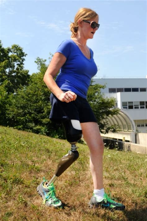Above Knee Amputee Prosthetic Facility Fitness Inspiration Amputee