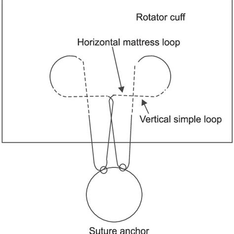 Modified Mason Allen Suture Diagram Figure 2 Modified Mattress Download Scientific Diagram