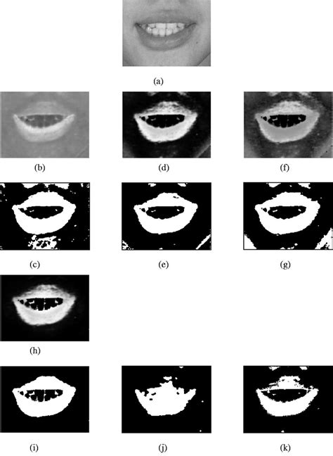A Original Lip Image 1 B Membership Distribution Obtained By Ct Download Scientific