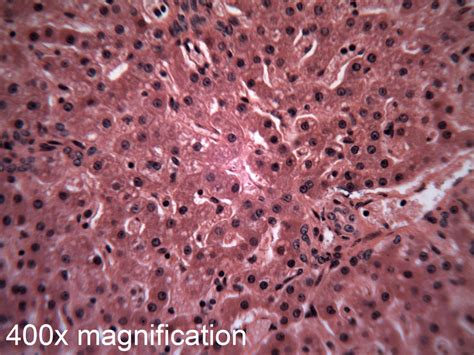 Human Liver Microscope Prepared Slide