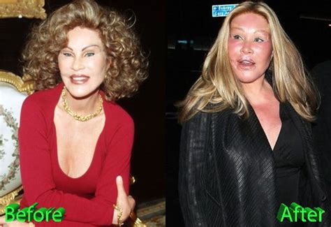 Catwoman Plastic Surgery Before And After