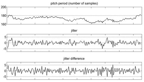 Jitter Pattern Of A Hoarse Voice Top The Pitch Period Contour