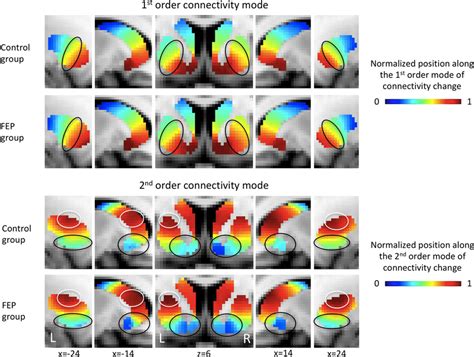 Disrupted Striatal Functional Connectivity Gradients In Fep Images
