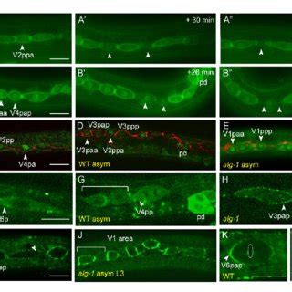 ALG 1 Regulates The Seam Cell Division Axis And Cell Motility A B Download Scientific