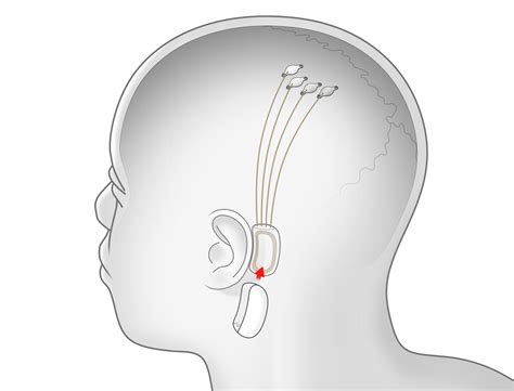 Neuralink Stock Price Chart Be Such A Good Blook Photogallery
