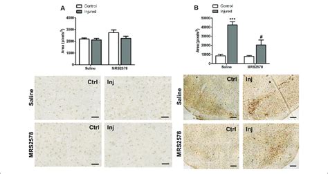 Immunohistochemical Analysis Of Iba 1 Labeling In Striatum And