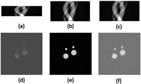 Projection Data Synthesis And Image Reconstruction A Sinogram Of 15 Download Scientific