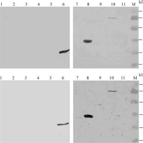 The Entire Np And Truncated Np Fragment Of Cchfv Expressed In This
