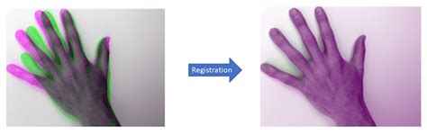 Medical Image Registration Matlab And Simulink