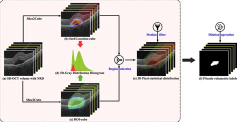 The Pipeline Of The Proposed 3d Grey Distribution Histogram Method Download Scientific Diagram