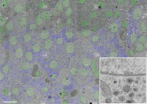 Automated Annotating Label In Nanotomy 2016 Wiley Analytical Science