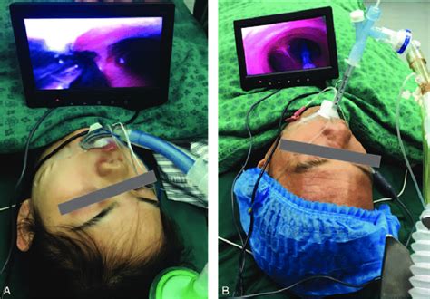 Endotracheal Intubation
