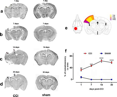 Progressive Cerebral Cortex Degeneration After Controlled Cortical Download Scientific Diagram