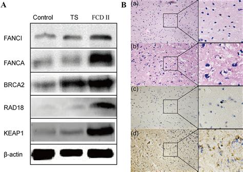 Validation Of The Expression Levels Of All Hub Genes And Expression Of Download Scientific