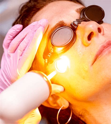Laser Treatment Services Hey Sister Spa