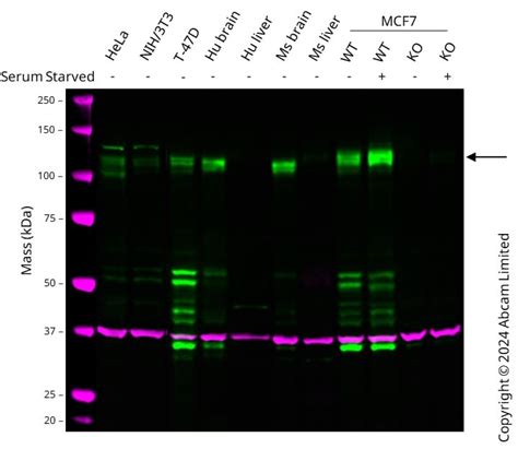 人cd167a Ddr1 Knockout Mcf7 Cell Line Abcam中文官网