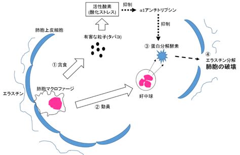 肺の聴診②副雑音連続性ラ音 都内の在宅医療訪問診療医療法人社団 鳳優会ほうゆうかい