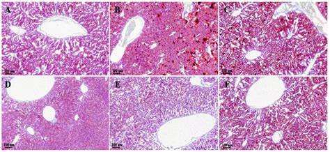 Oil Red O Staining Of Mouse Liver Tissue Treated Without Or With Epph