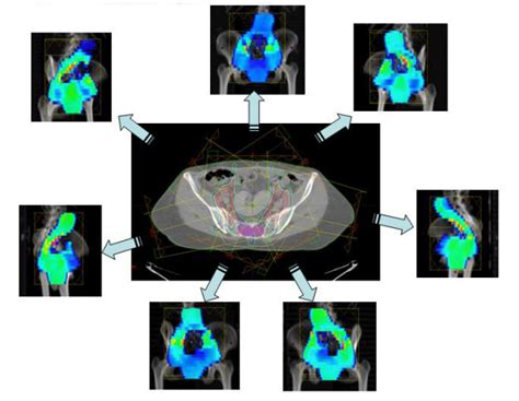 Radiation Fluence Shows Radiation Fields Their Fluence Maps And The