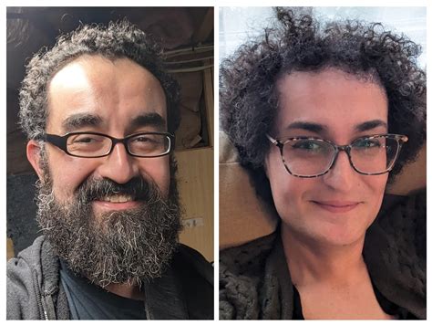 9 Months Vs 9 Months Hrt 36 Mtf R Transtimelines