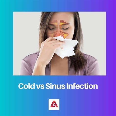 Difference Between Sinus Congestion And Sinus Infection At Sara Gosman Blog