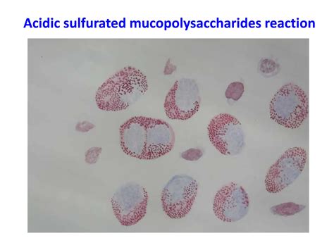 Presentation On Leukocytosis Leukemiapptx