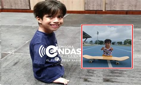 ¡indignante Niño Sin Piernas Ni Brazos Fue Víctima De La Delincuencia