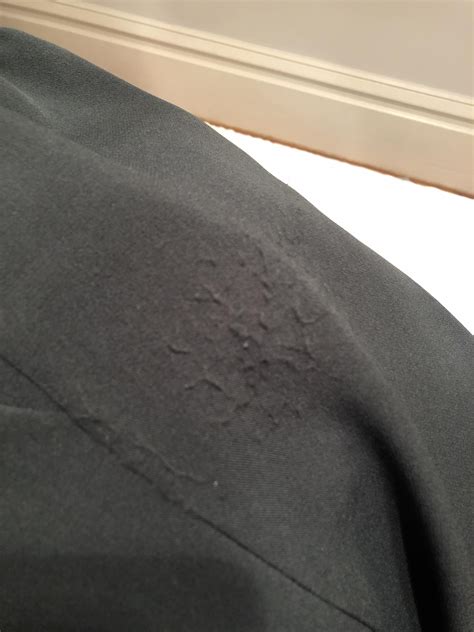 How To Repair Remove This Fuzz From My Pants They Are Brand New And I Can Sort Of Pull The