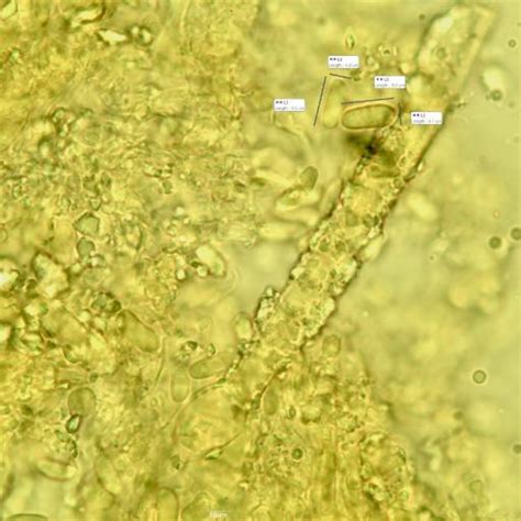 Devils Fingers Clathrus Archeri Mushroom Identification Habitat And Uses