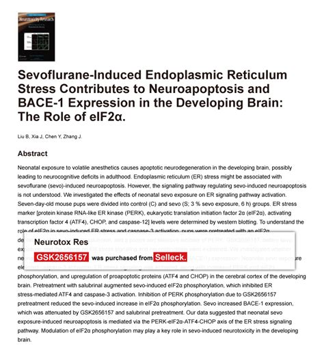 Gsk2656157 ≥99hplc Selleck Perk Inhibitor Qcfile