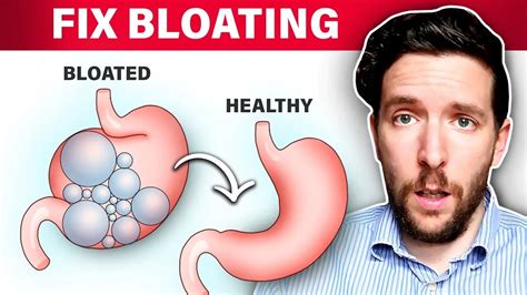 Top 10 Ways To Fix Gas And Bloating 2023 Youtube