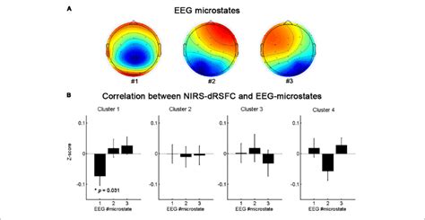 The Topographies Of The Eeg Microstates A And The Statistical