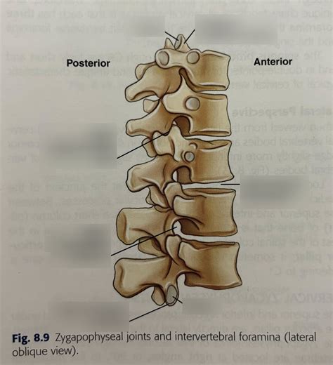 T Spine Zygapophyseal Joints And Intervertebral Foramina Labeling Diagram Quizlet