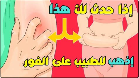 الأطباء يحذرونك علامات على أن الكبد مليء بالسموم وفي خطر وبحاجة