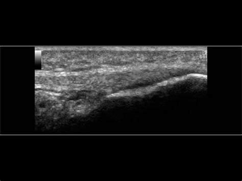 Scanning Protocols 6 Musculo Skeletal Joints And Tendons Case 66