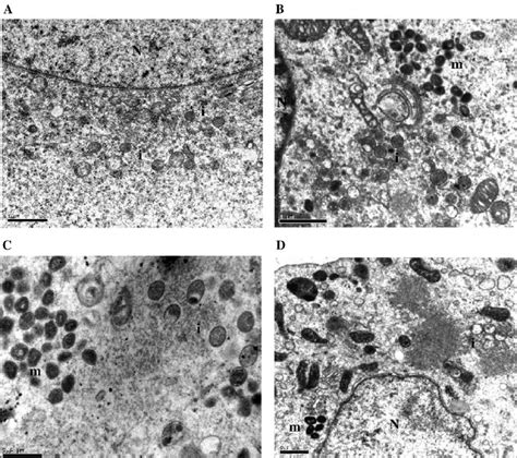 Electron Microscopy Analysis Of Four Cell Types Infected With Vtt