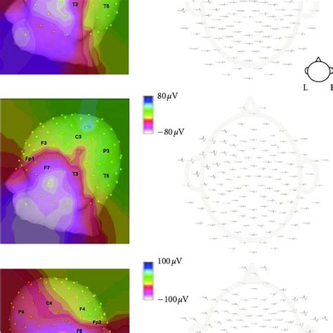 Spike Voltage Topography Left Averaged Spike Voltage Topography Download Scientific Diagram