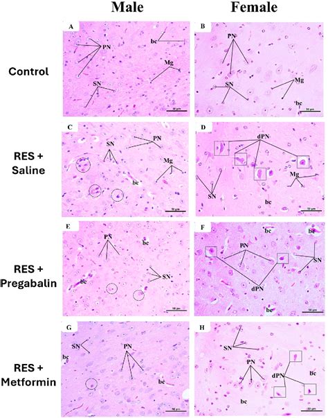 Figure 11 From The Antinociceptive Effects And Sex Specific