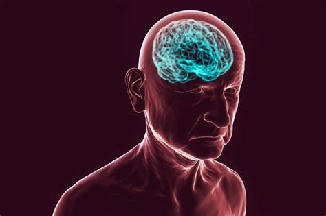 Fda მ დაამტკიცა ახალი ალცჰეიმერის საწინააღმდეგო წამალი “leqembi” ახალი ამბები