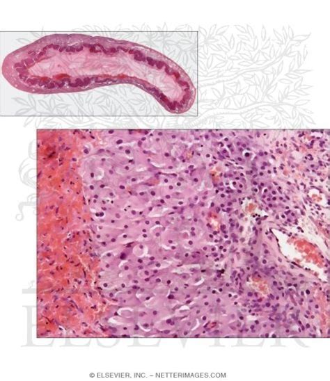Low Power Light Micrograph Of The Ovary With Light Micrograph Of Part