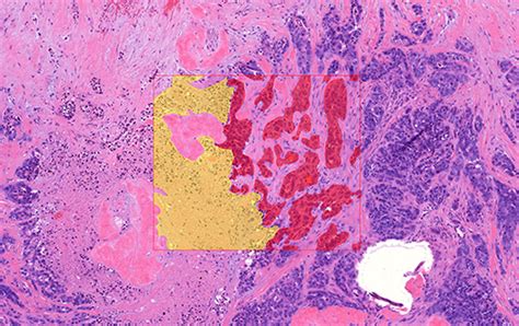 Histomicstk Manage Analyze And Visualize Your Digital Pathology Data